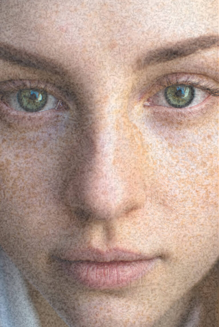 Treating Visual Snow | Visual Snow Initiative